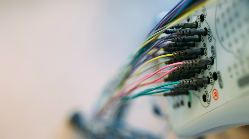 Electrocardiogram jeb EKG - Sirds veselība - GK neiroklīnika